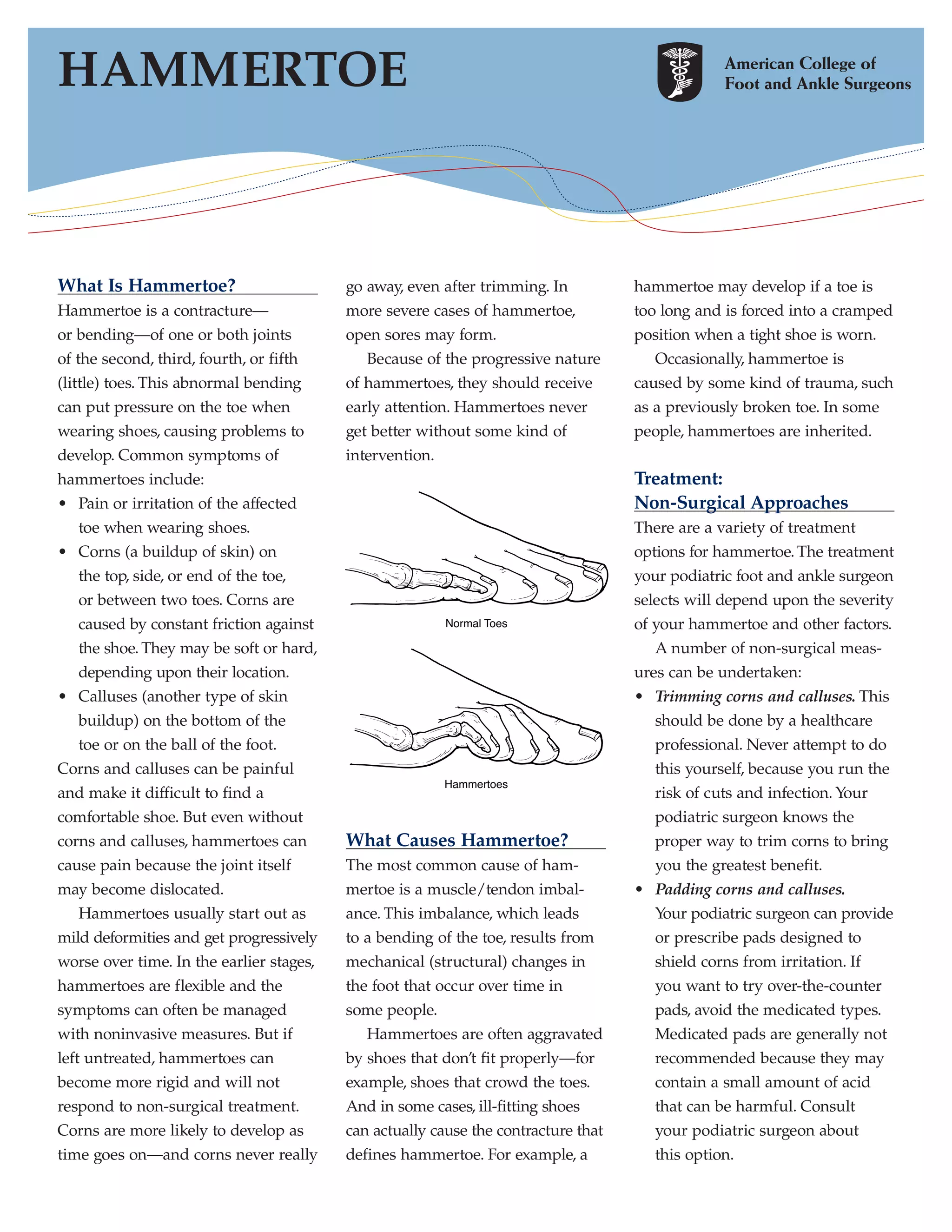 Hammer Toes: Causes, Symptoms and Treatments | PDF
