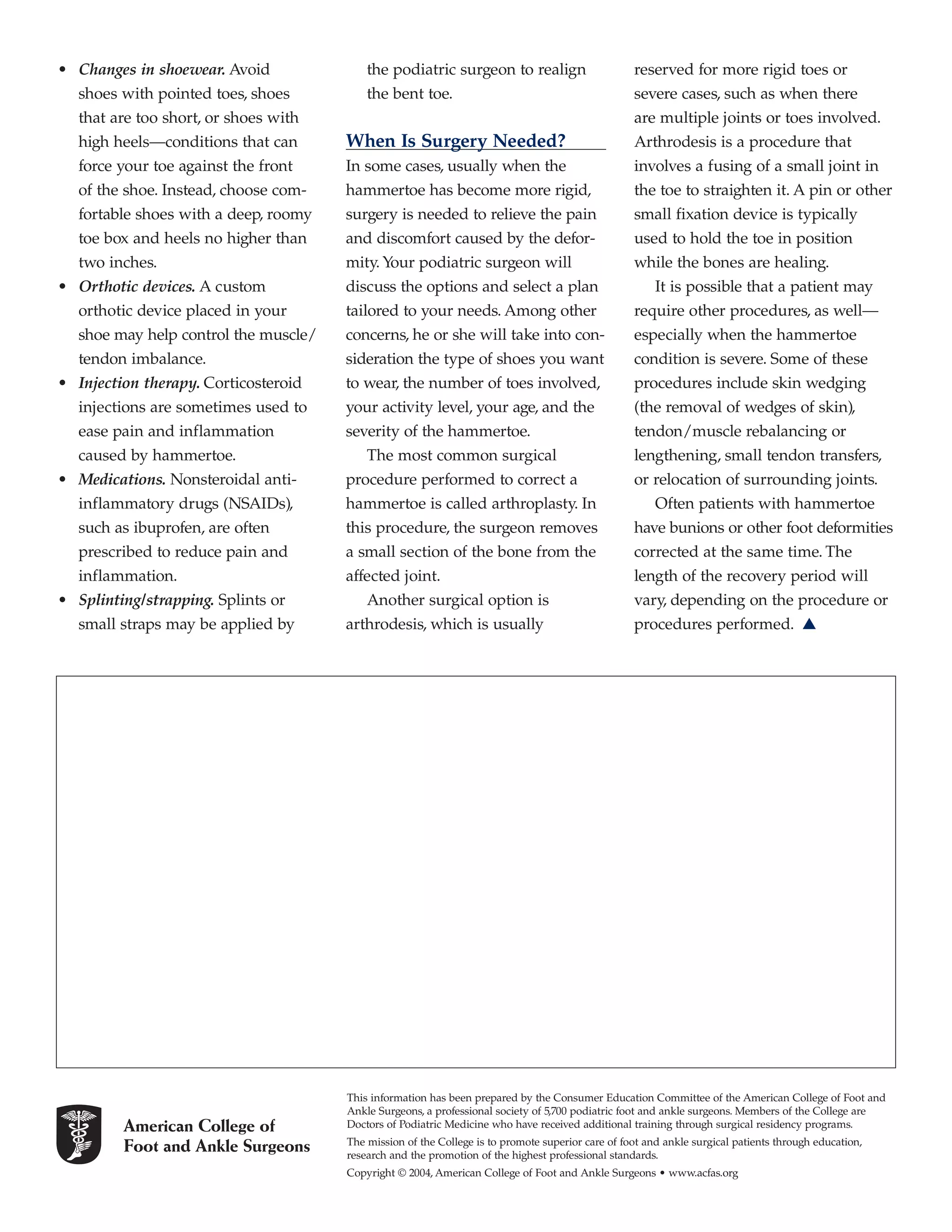 Hammer Toes: Causes, Symptoms and Treatments | PDF