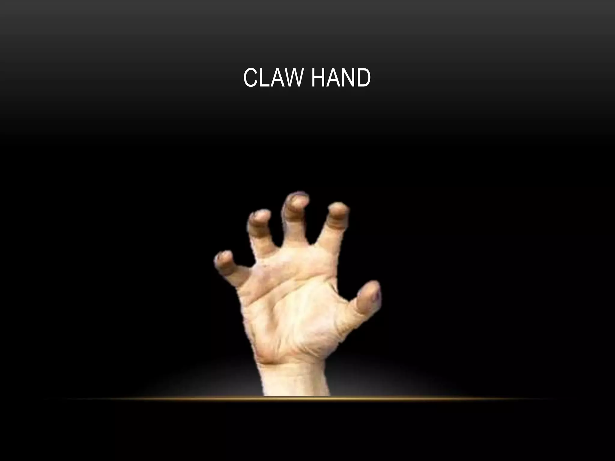 American sign language handshapes and abc's | PPTX