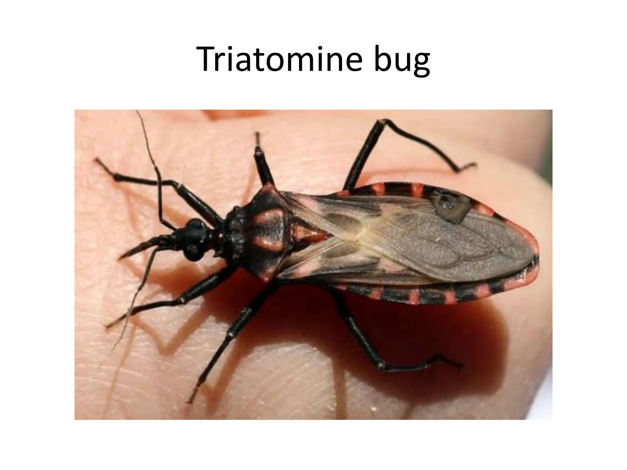 AMERICAN TRYPANOSOMIASIS-CHAGAS DISEASE.pptx
