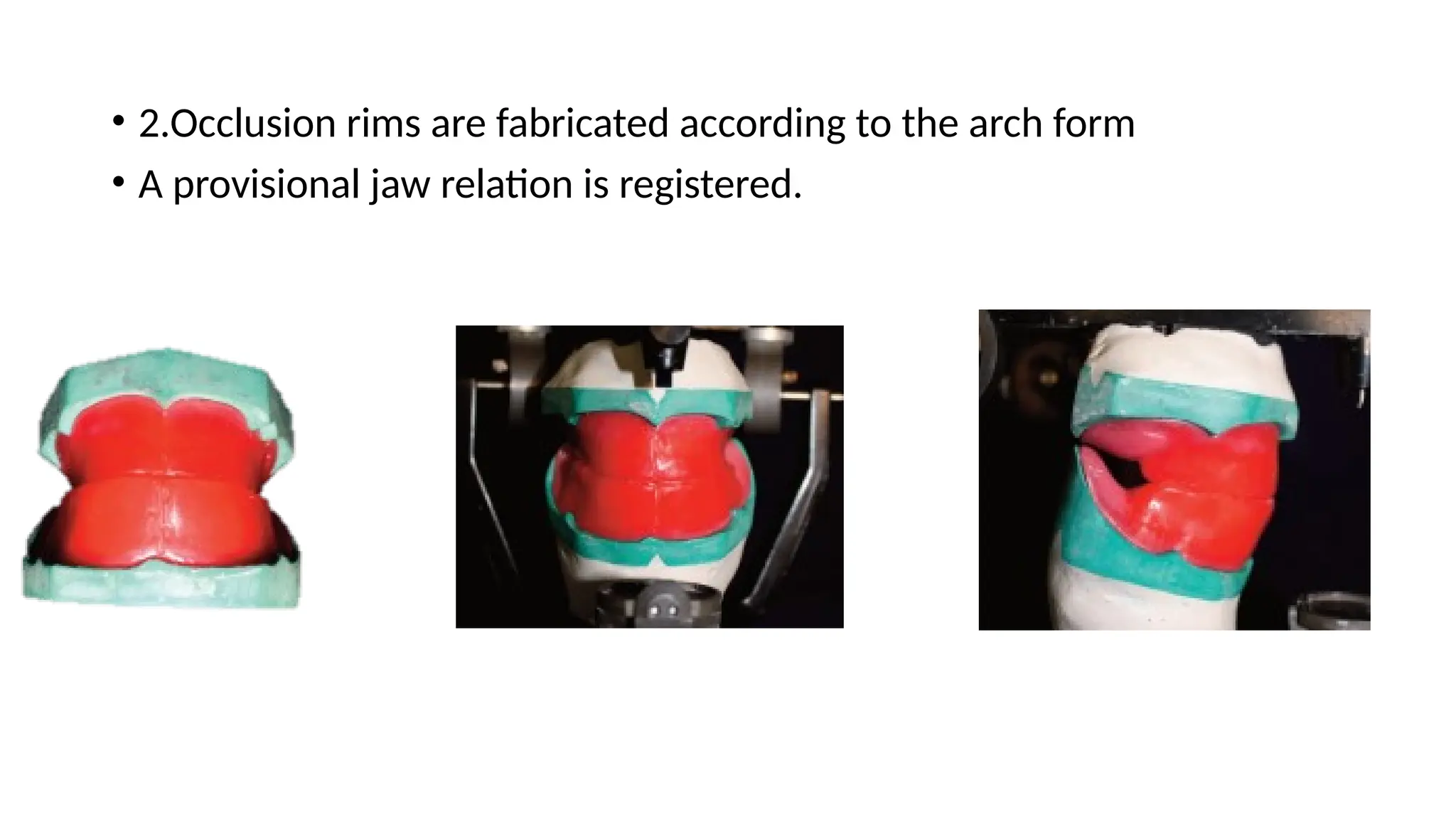 A METHOD OF CROSSBITE SETTING in class 3.pptx