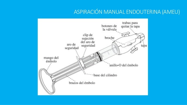 Aspiracion manual endouterina (AMEU)