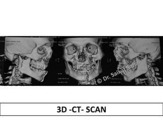Submental Intubation - (Steps Of The Procedure Explained) | PPSX