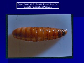 A) miasis slp | PPT
