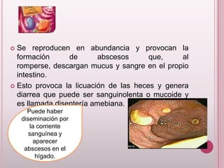 Amibiasis | PPTX