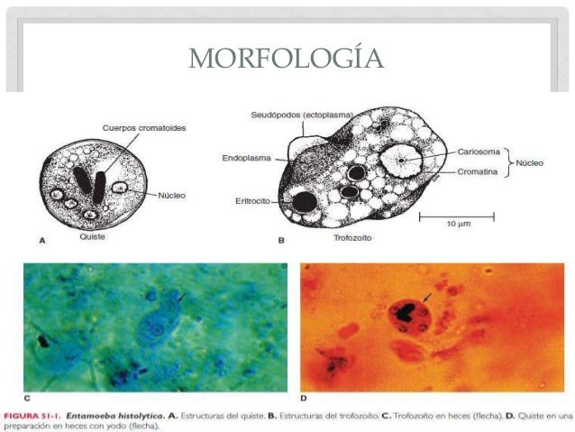 Amibiasis int y extra int odonto