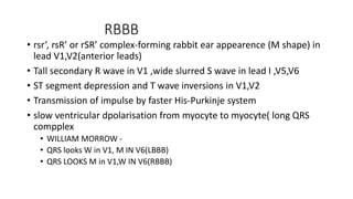 AMI DIAGNOSTICS IN CASE OF LBBB AND.pptx