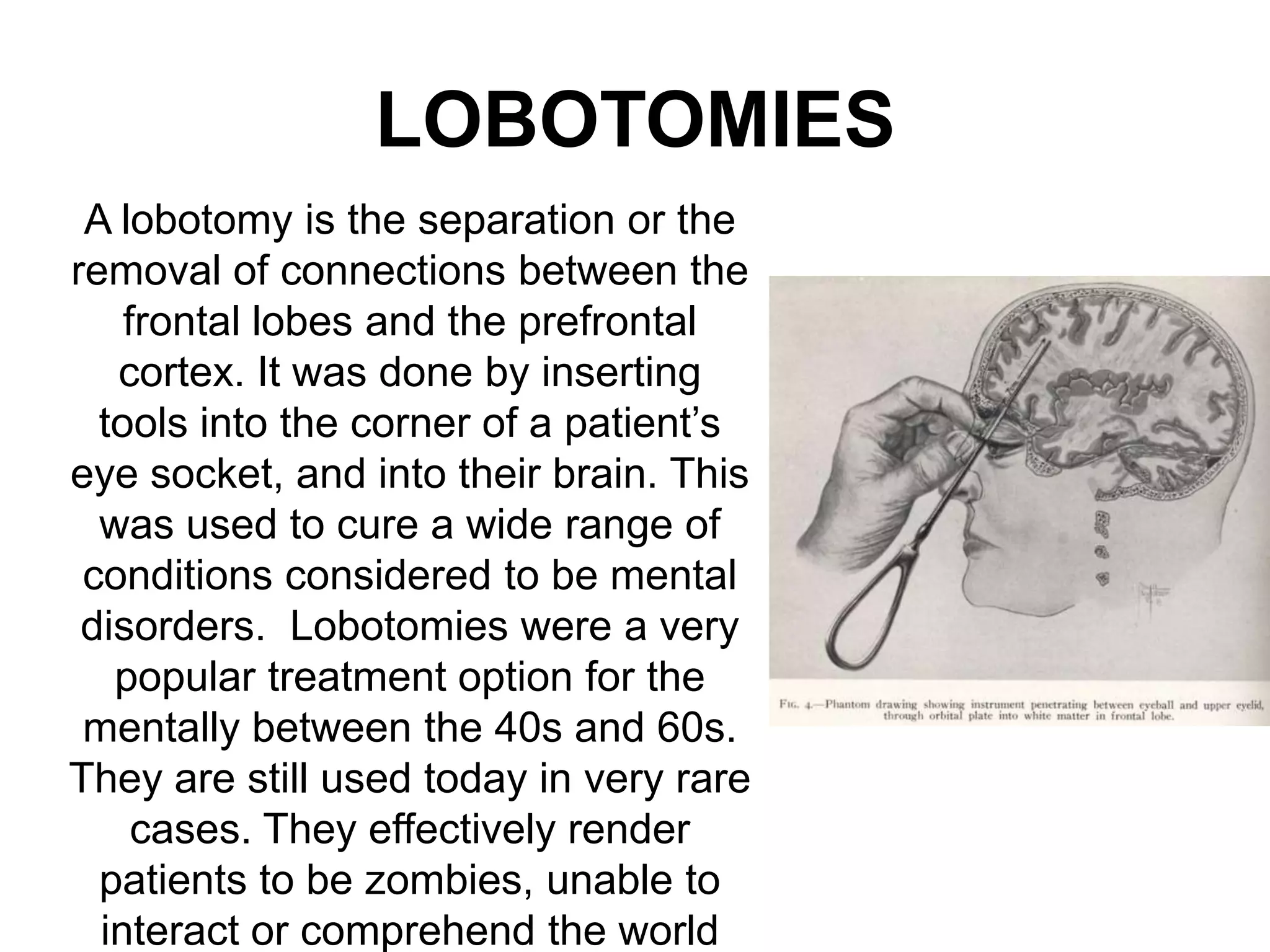 Cosi - Mental Asylums Through Time | PPTX