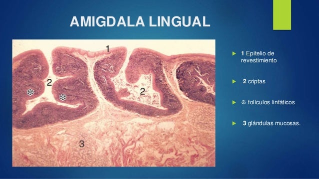 Amigdalas