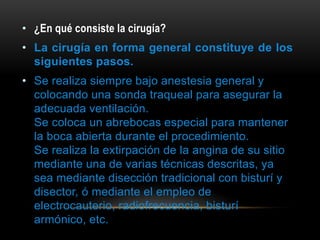 Amigdalectomia | PPTX