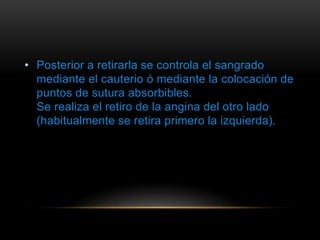 Amigdalectomia | PPTX
