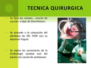 Amigdalectomia 1 | PPTX