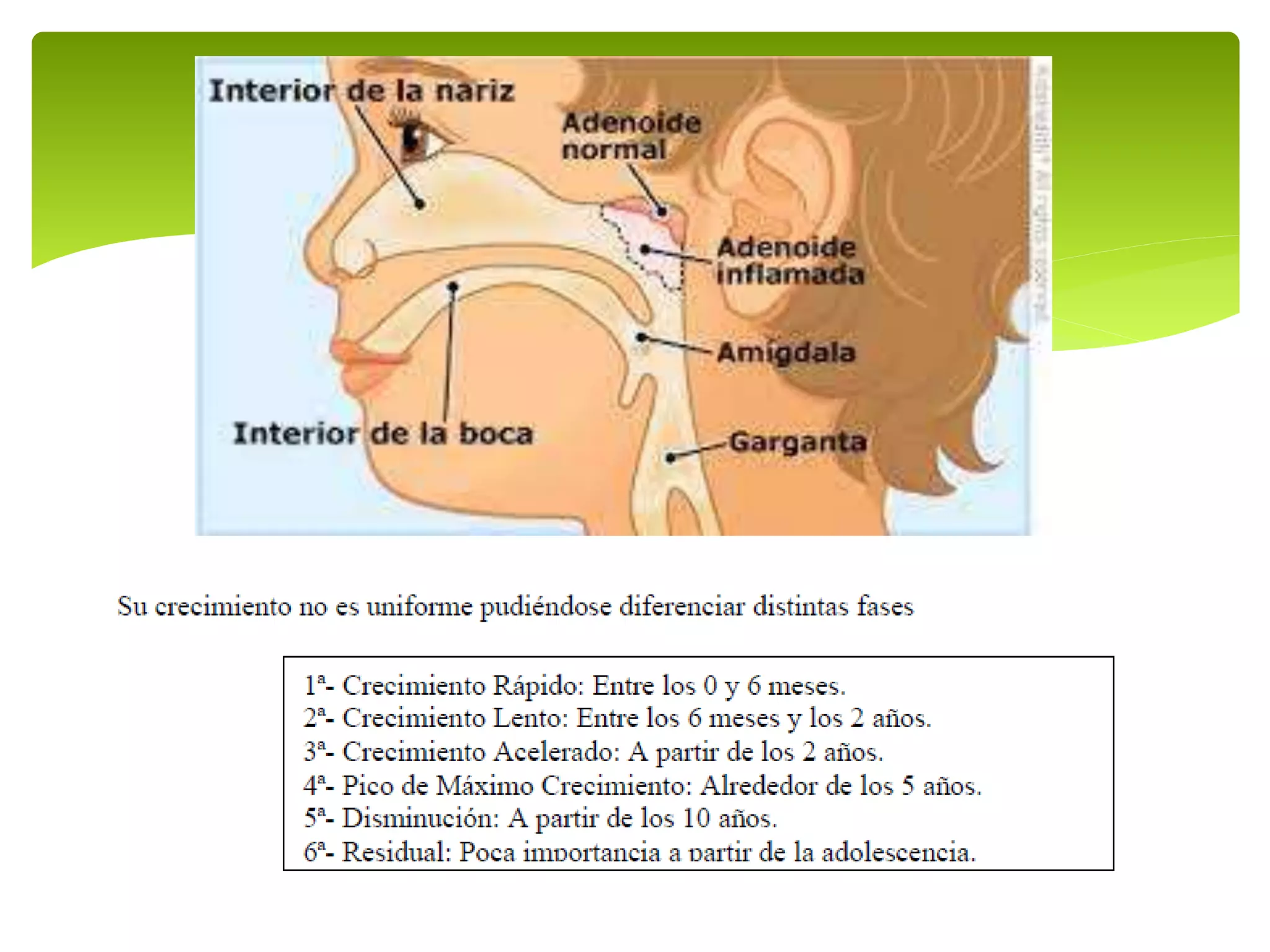 AMIGDALECTOMIA Y ADENOIDECTOMIA.pptx