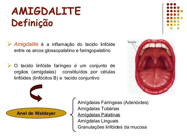 Amigdalite ppt