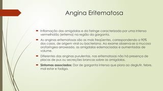 Amigdalites estudo sistêmatico sobre suas principais causas, etiologia ...