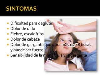 Amigdalitis | PPTX
