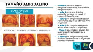 Puntuación De Hipertrofia Amigdalina