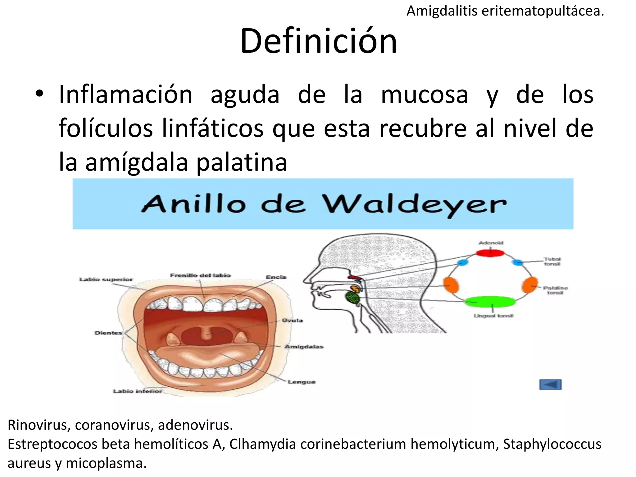 Amigdalitis | PPT