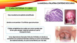 Amigdalitis | PPTX