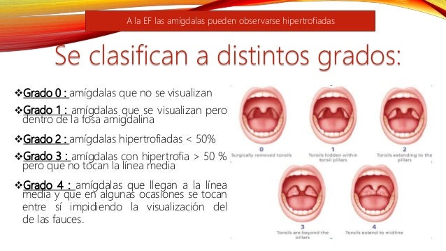 Crostas De Remocao De Amigdalas