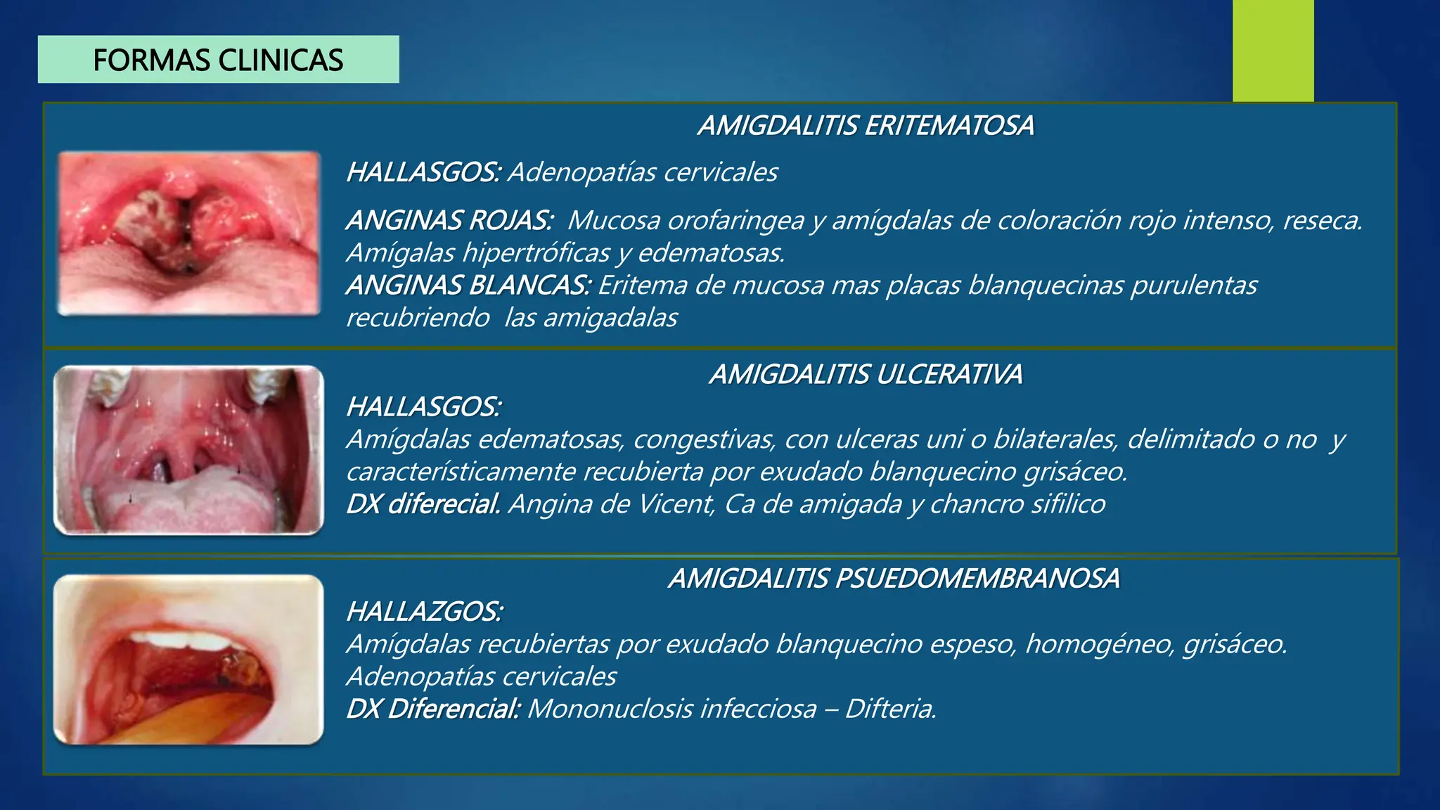 Amigdalitis cristian completa información.pptx