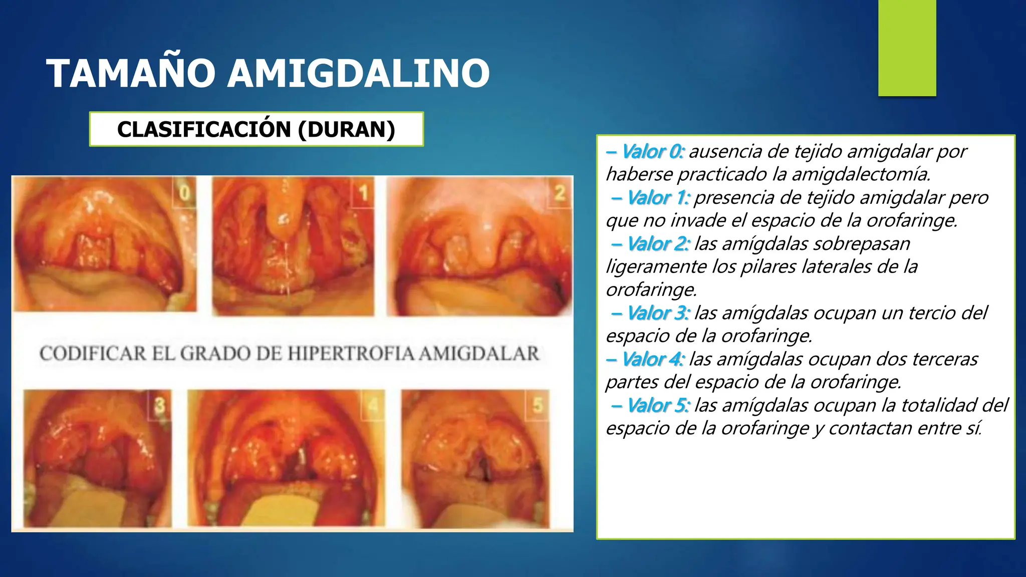 Amigdalitis cristian completa información.pptx