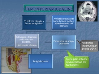 Amigdalitis crónica | PPT