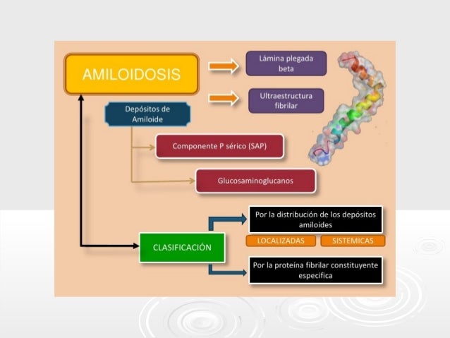Amiloidosis