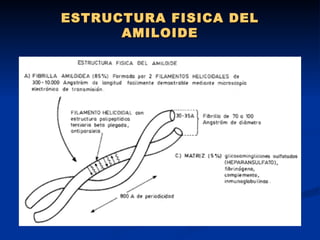 Amiloidosis Renal | PPT