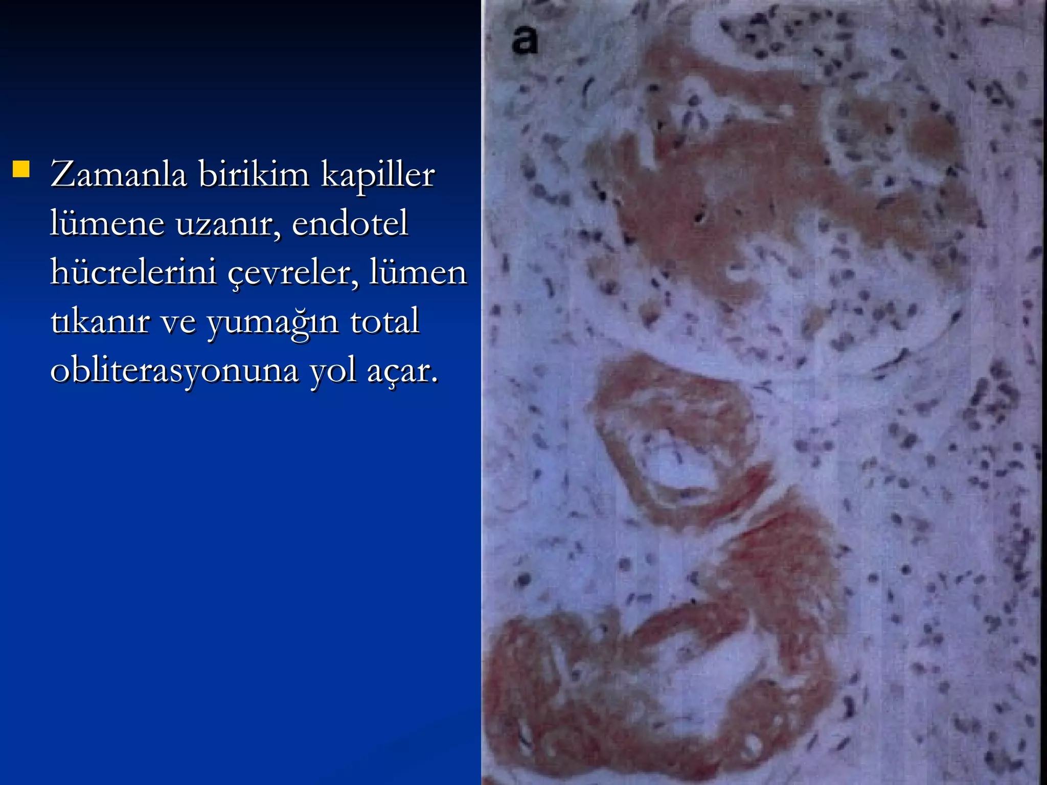 Amiloidoz (fazlası için www.tipfakultesi.org ) | PPT