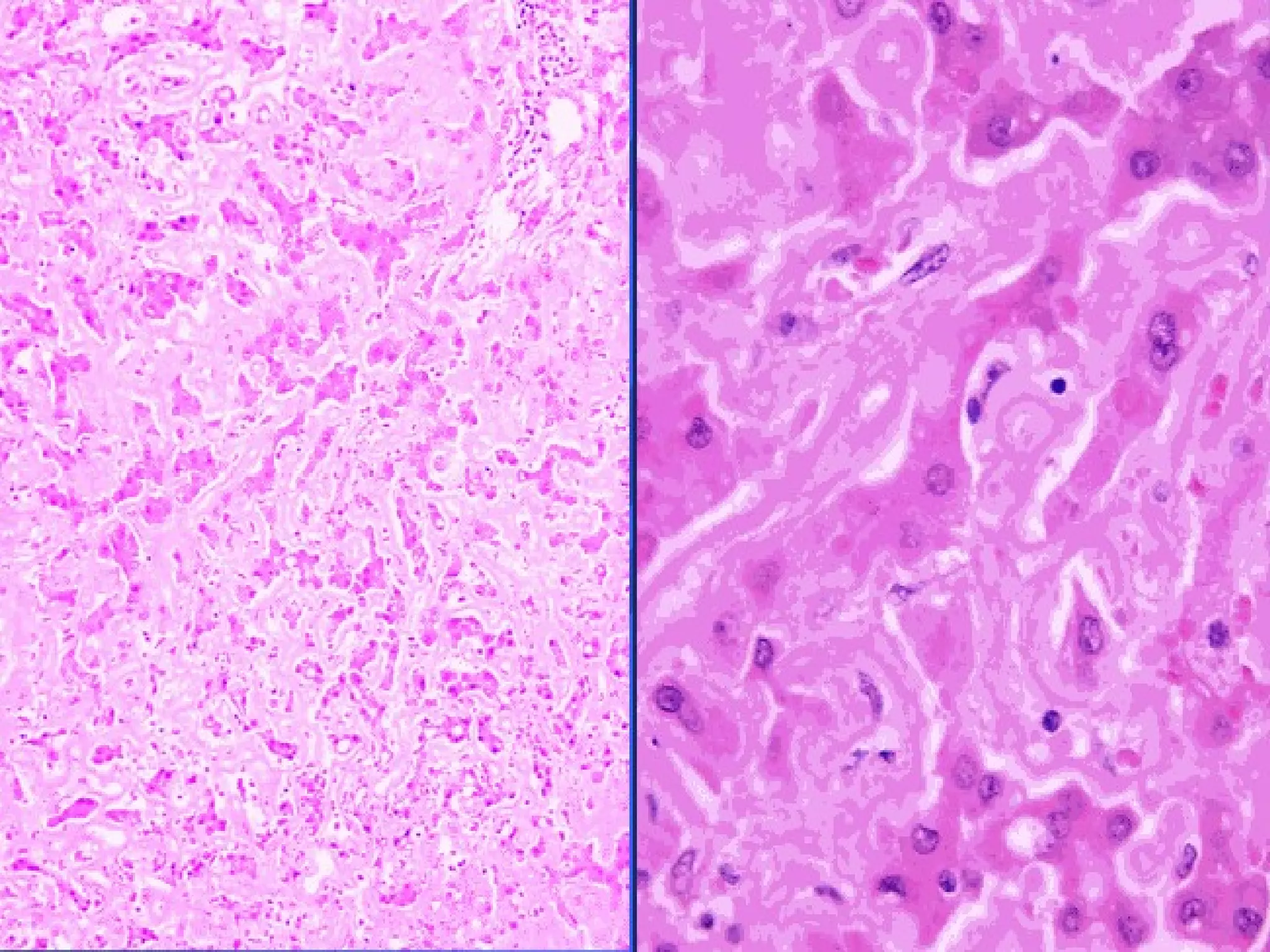 Amiloidoz (fazlası için www.tipfakultesi.org ) | PPT