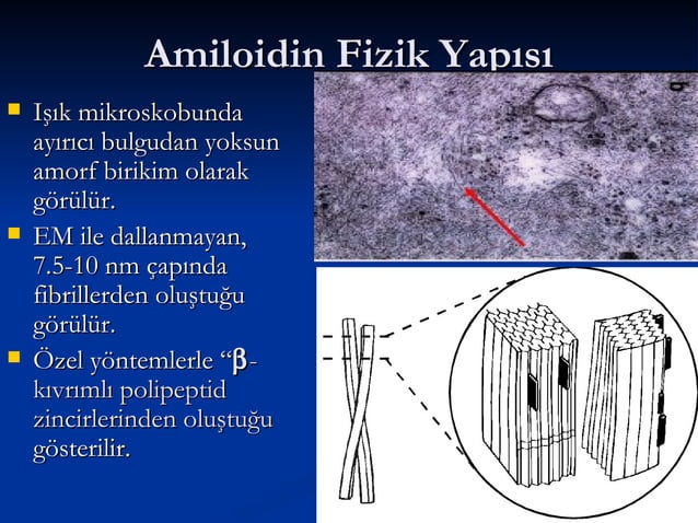 Amiloidoz (fazlası için www.tipfakultesi.org ) | PPT