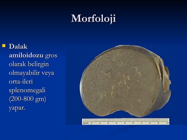 Amiloidoz (fazlası için www.tipfakultesi.org ) | PPT