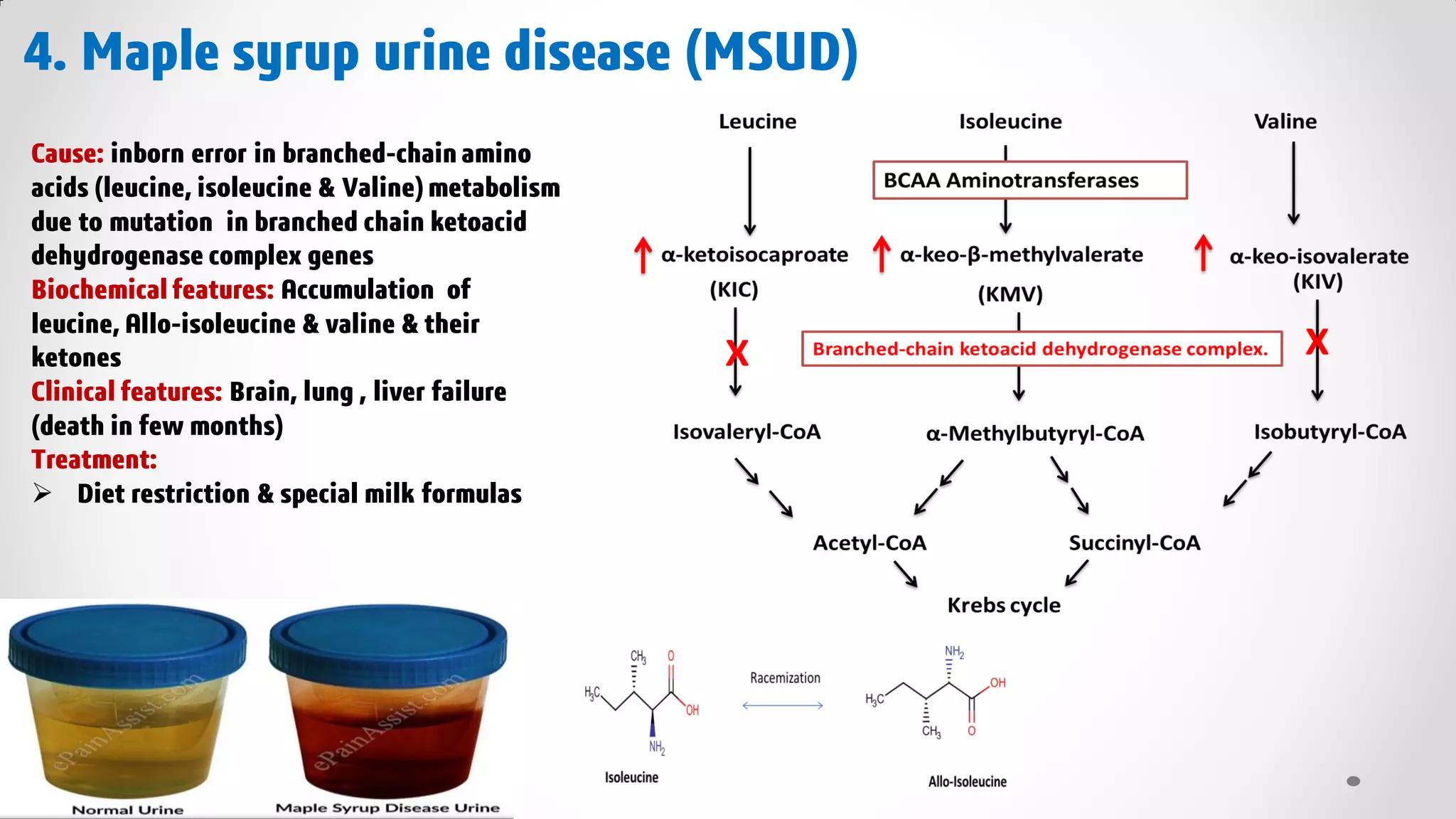 Inborn Error of Amino Acids Metabolism .pdf