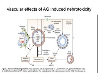 Aminoglycoside induced nephrotoxicity | PPTX