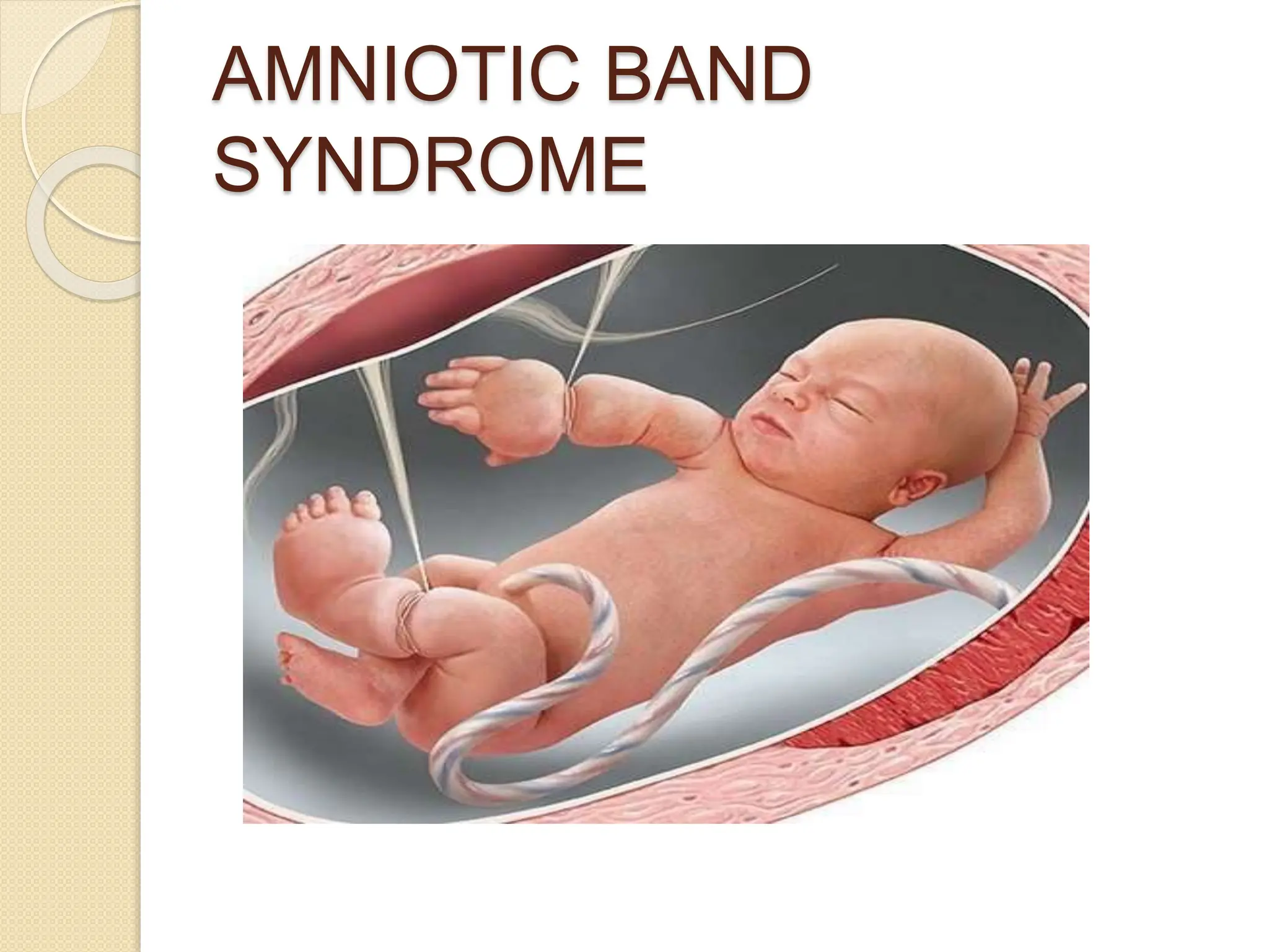 AMINOSCOPY AND FETOSCOPY INVASIVE PROCEDURE.pptx