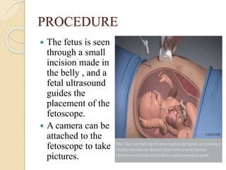 AMINOSCOPY AND FETOSCOPY INVASIVE PROCEDURE.pptx