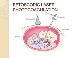 AMINOSCOPY AND FETOSCOPY INVASIVE PROCEDURE.pptx