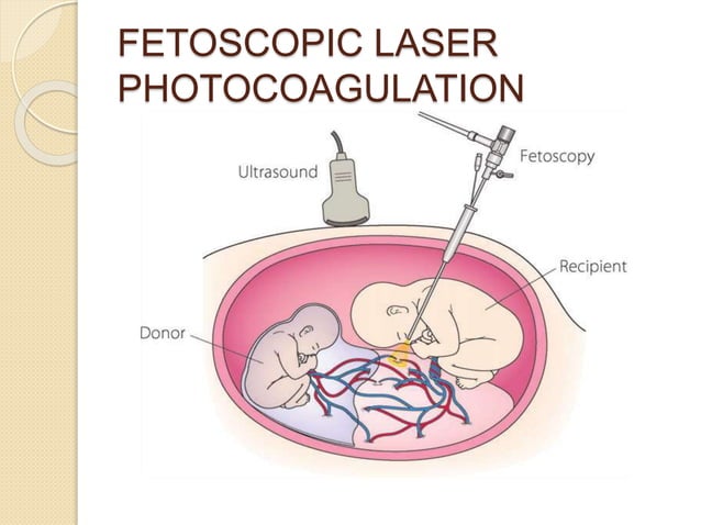 AMINOSCOPY AND FETOSCOPY INVASIVE PROCEDURE.pptx