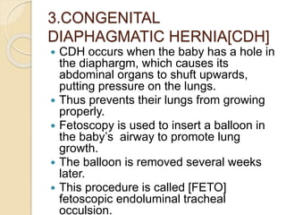 AMINOSCOPY AND FETOSCOPY INVASIVE PROCEDURE.pptx