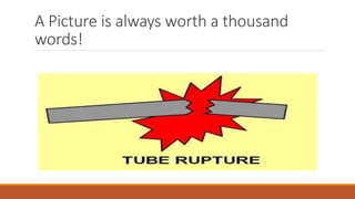 Tube rupture and other terminologies in Chemical Engineering | PPT
