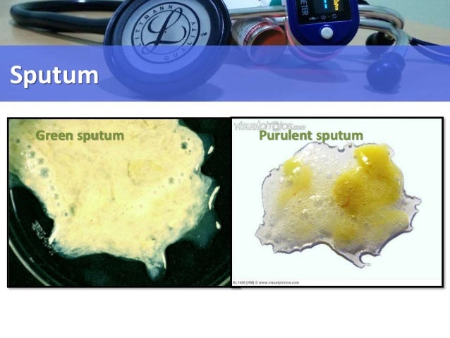 cough approach by aMit!!! GMCH