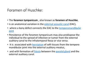 Anatomy of ear | PPT
