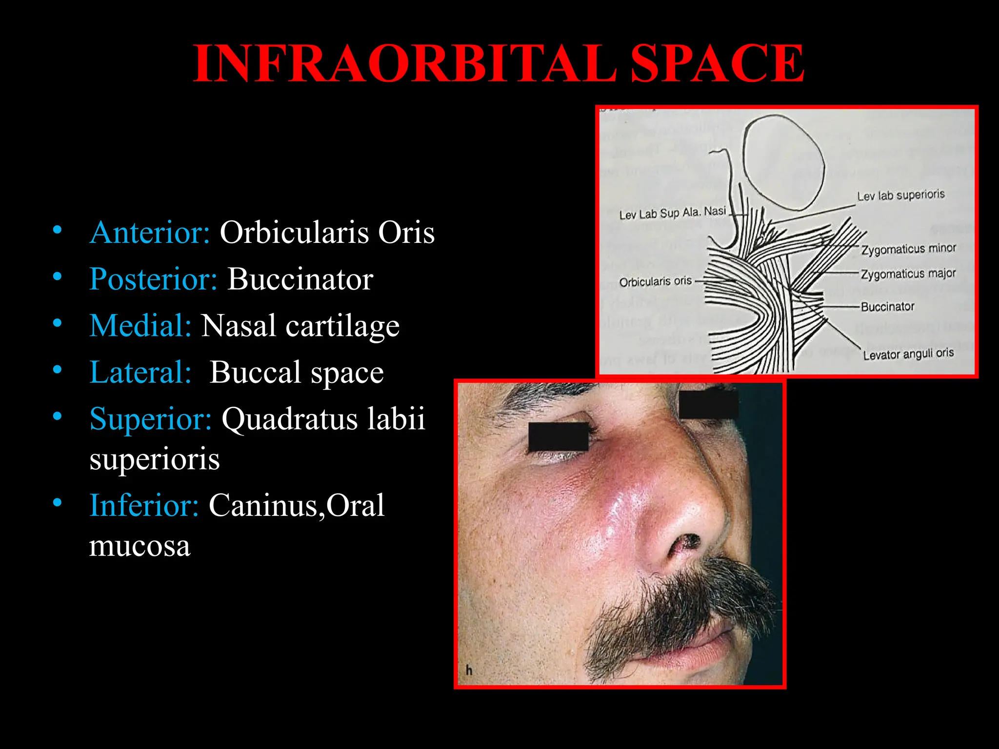 space infection in oral [Autosaved].pptx