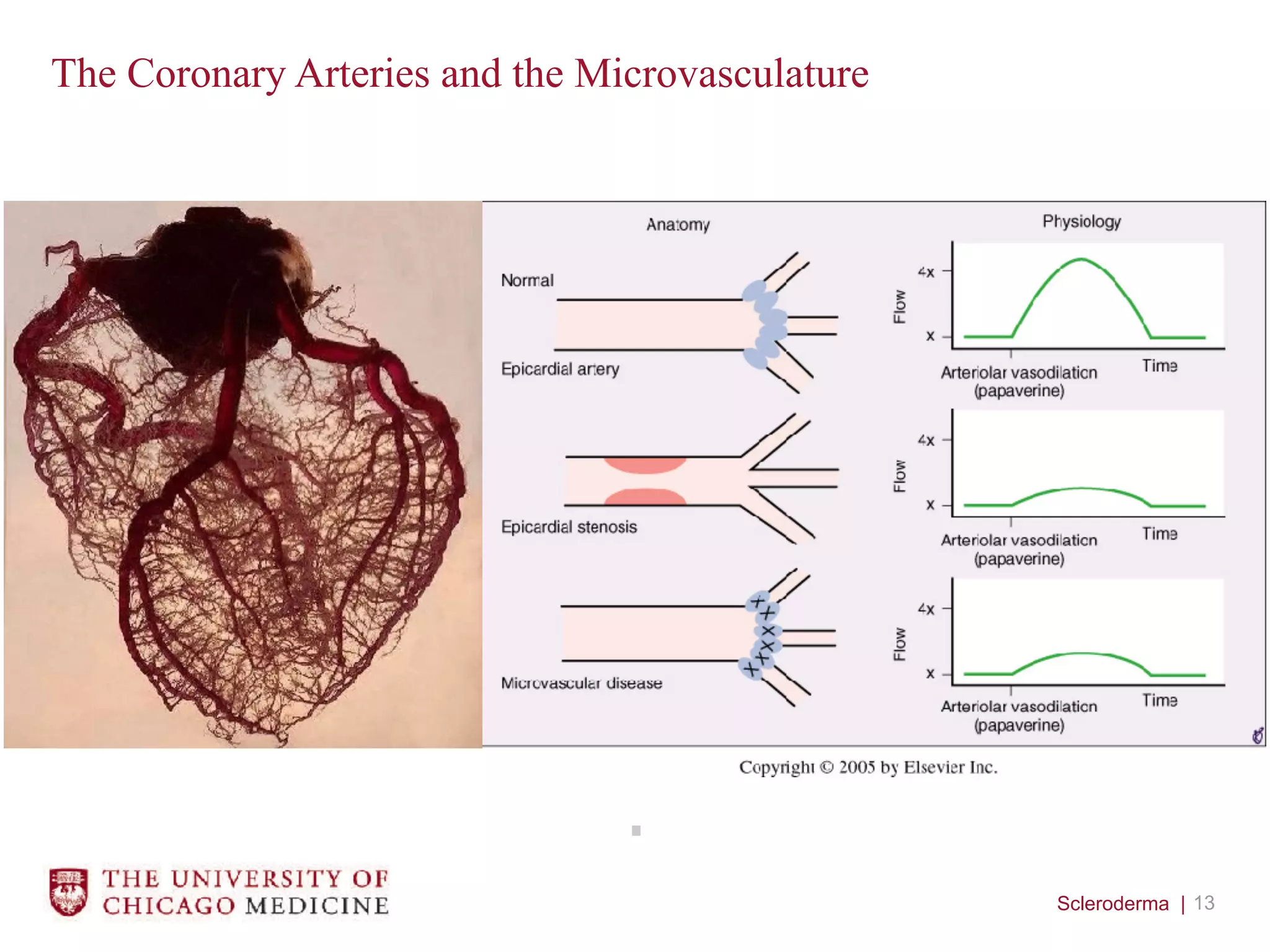 Normal Heart Function and Changes that can Occur in Scleroderma | PDF