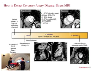 Normal Heart Function and Changes that can Occur in Scleroderma | PDF