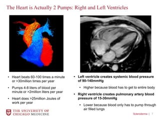 Normal Heart Function and Changes that can Occur in Scleroderma | PDF