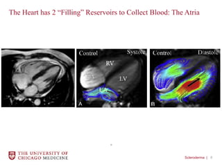 Normal Heart Function and Changes that can Occur in Scleroderma | PDF