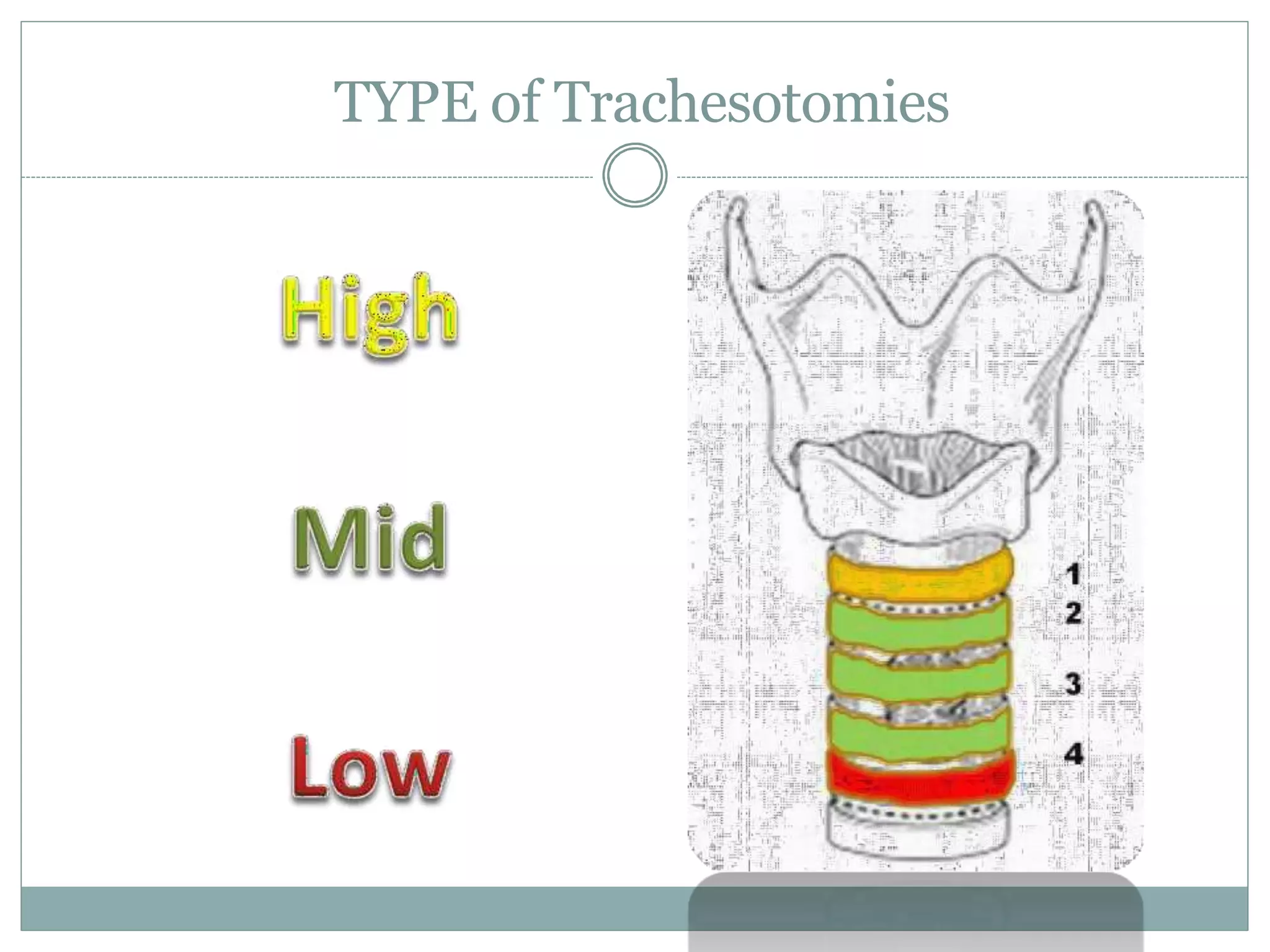 tracheostomy | PPTX