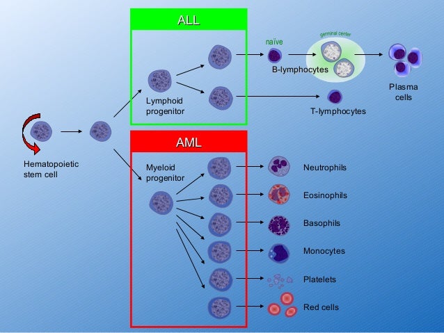 Acute myeloid leukemia